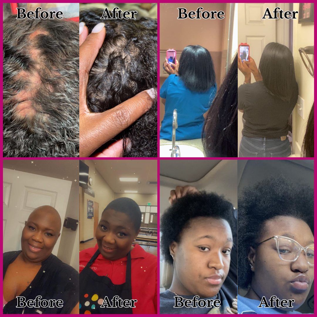 Jumbo Stimulating Hair Growth Oil | The Mane Attraction
